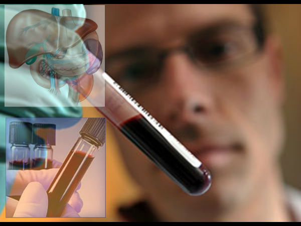 Transaminasas hepáticas: ¿qué son?